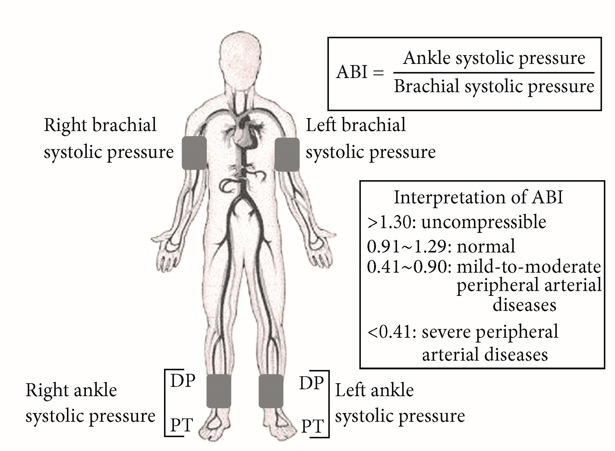 Peripheral Arterial Insufficiency (PAI) – The Good Doctor